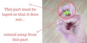 Finger Dislocation Treatment and Recovery (My Experience) – Injury ...