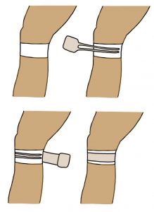 How to Apply Tape for Knee Pain: 4 Techniques - Injury Health Blog