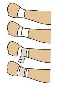 How to Use Kinesiology Tape for Wrist Pain and Injuries – Injury Health ...