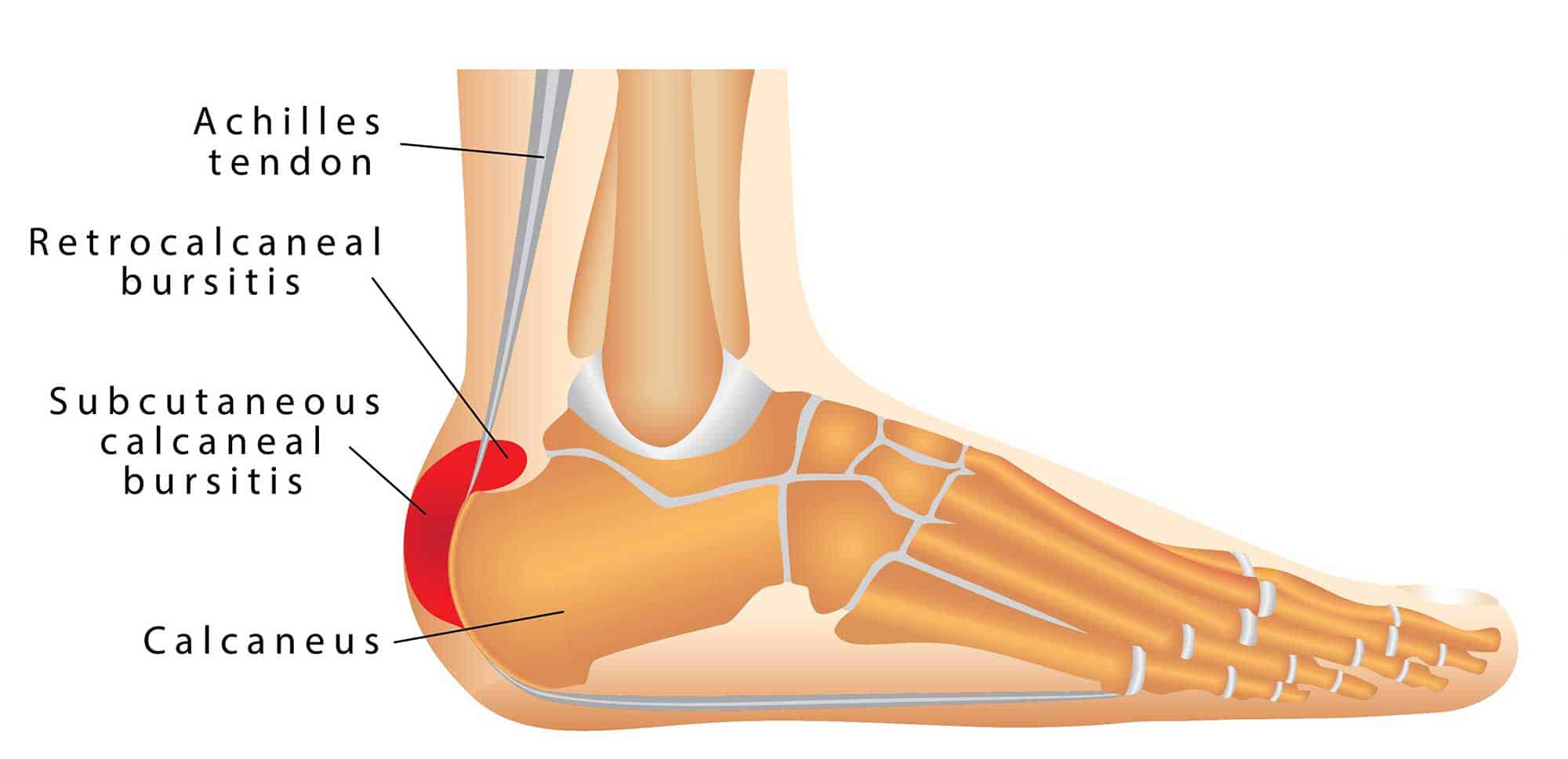 Achilles Tendon Human Anatomy Function Location And Injuries 